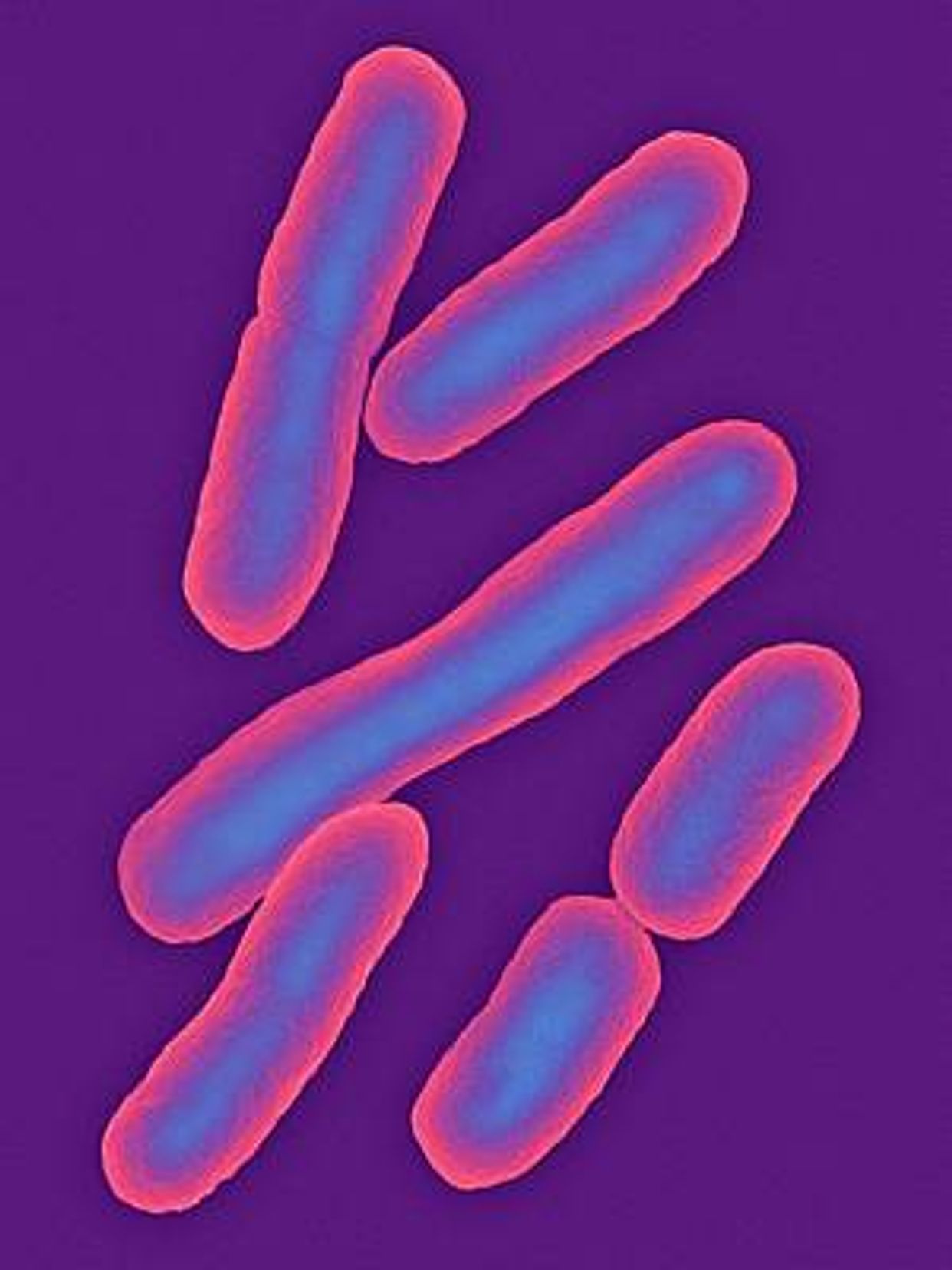 Gammaproteobacteria > Diagnostic And Tips For Controlling 🌿 PlantIn